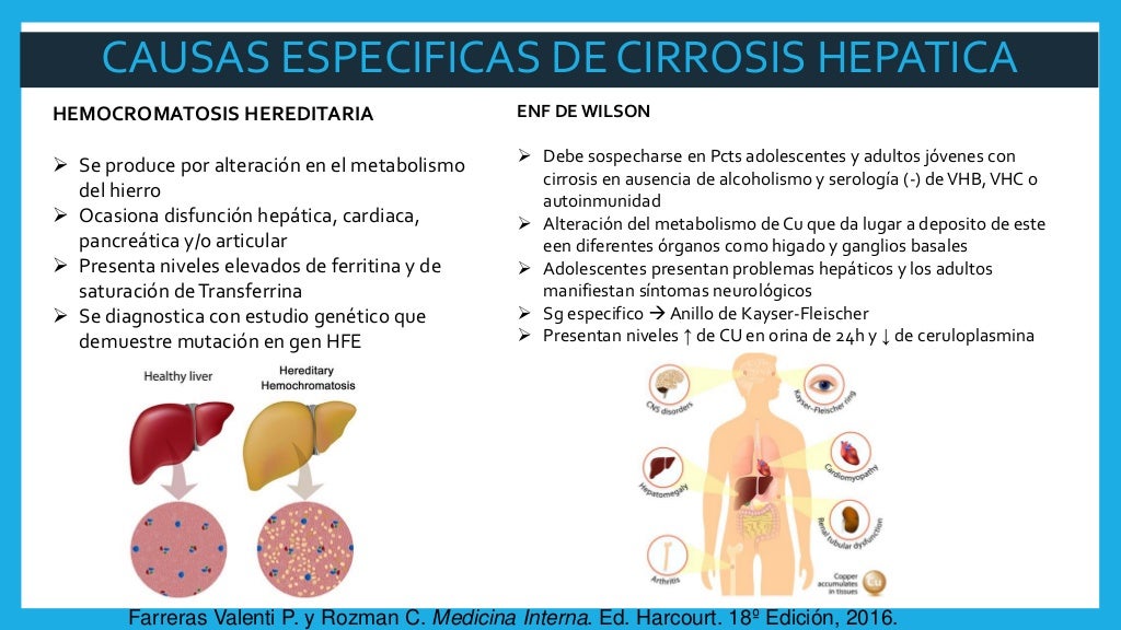 Cirrosis hepatica