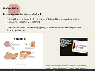 Cirrosis hepatica | PPTX