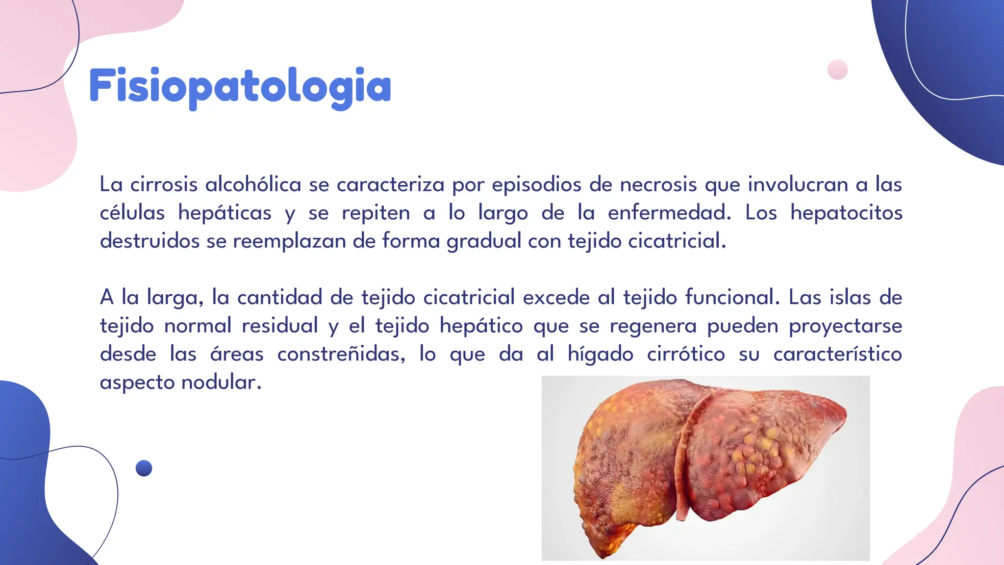 cirrosis hepatica ciencias medicas.9999999999pdf | PDF