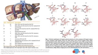CIRROSIS HEPATICA ABORDAJE CLINICO ACTUALIZADO | PPTX | Diseases and ...