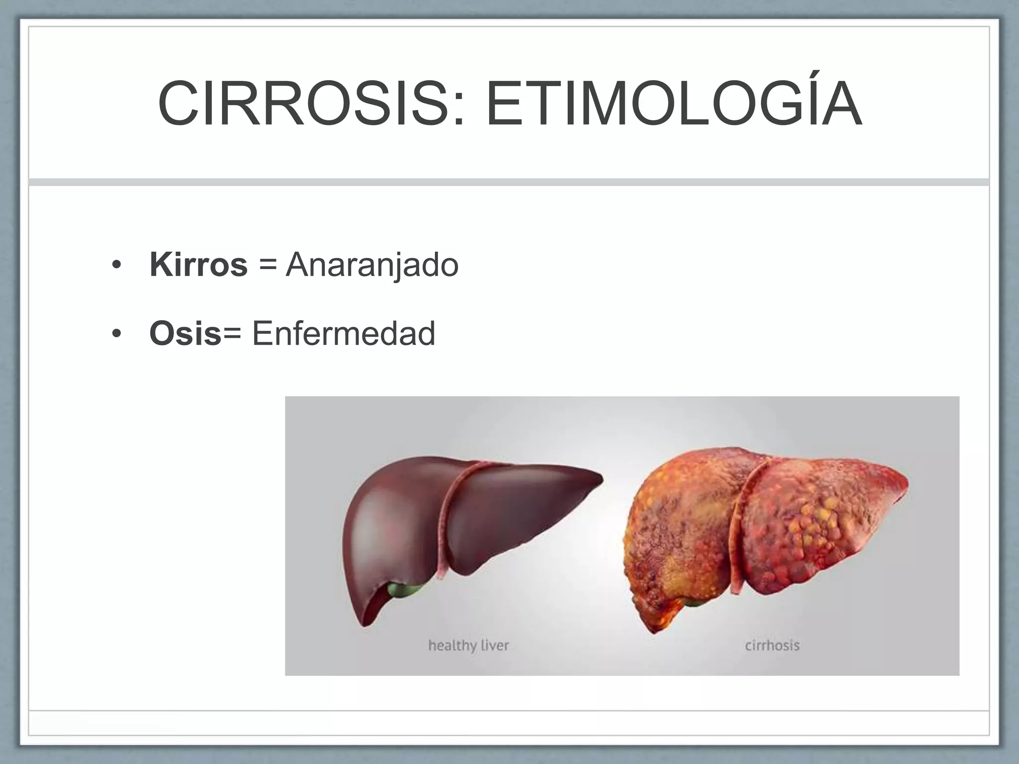Cirrosis hepática e hipertensión portal, Complicaciones: Ascitis ...
