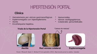Cirrosis Hepatica Gastroenterologia 6to Año Pptx