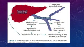 cirrosis hepatica y ascitis fisiopatologia | PDF
