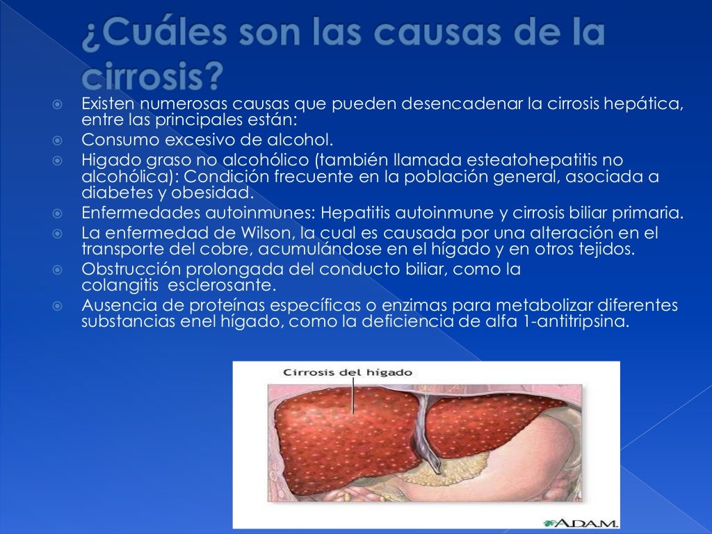 Cirrosis Hepática Causas Y Consecuencias
