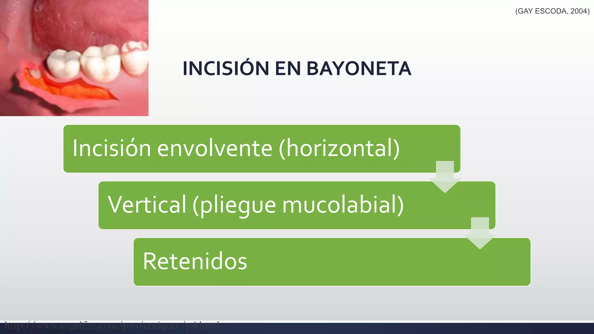 Cirugía oral - INCISION Y COLGAJO | PPTX