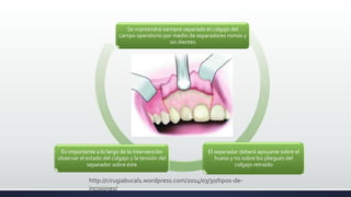 Cirugía oral - INCISION Y COLGAJO | PPTX
