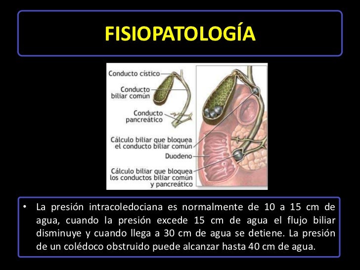 Cirugía coledocolitiasis y estenosis del esfinter de oddi. derivaci…