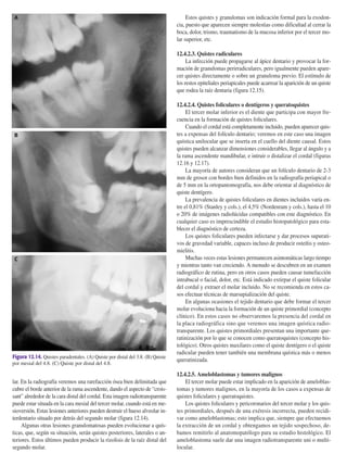 Cirugía clasificaciones posicion tercer molar | PDF