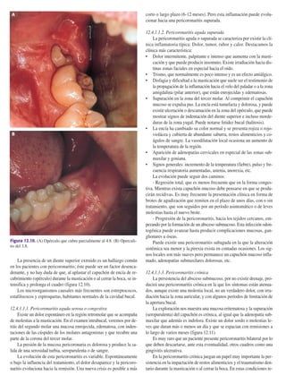 Cirugía clasificaciones posicion tercer molar | PDF
