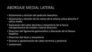 Cirugía de colon.pptx