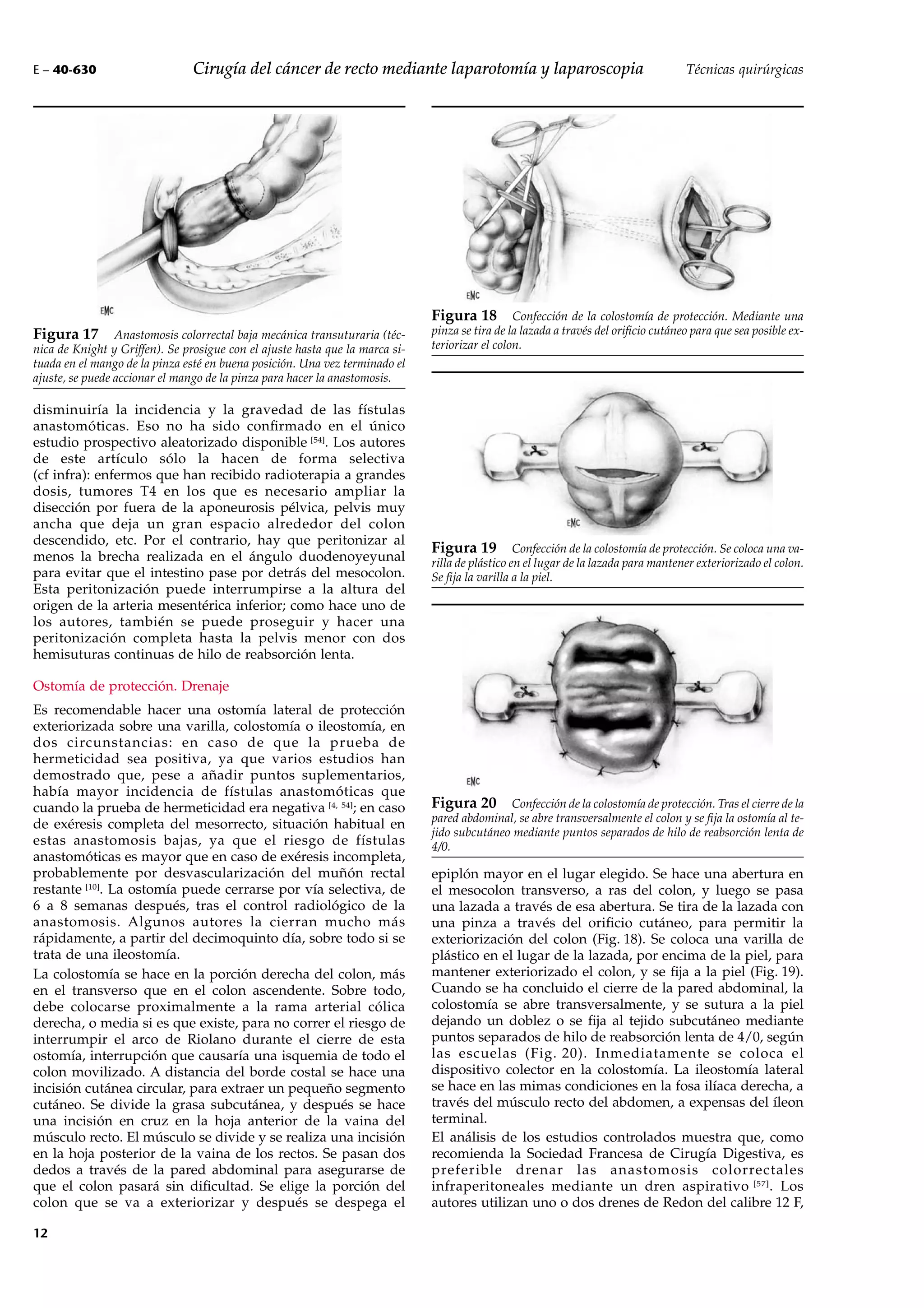 EMC. Cirugía del cáncer de recto mediante laparotomía y laparoscopia | PDF