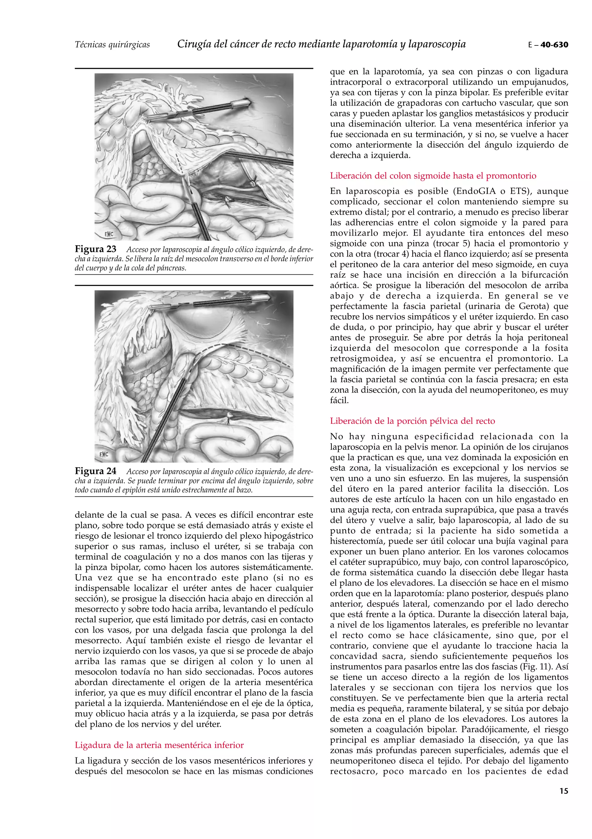EMC. Cirugía del cáncer de recto mediante laparotomía y laparoscopia | PDF