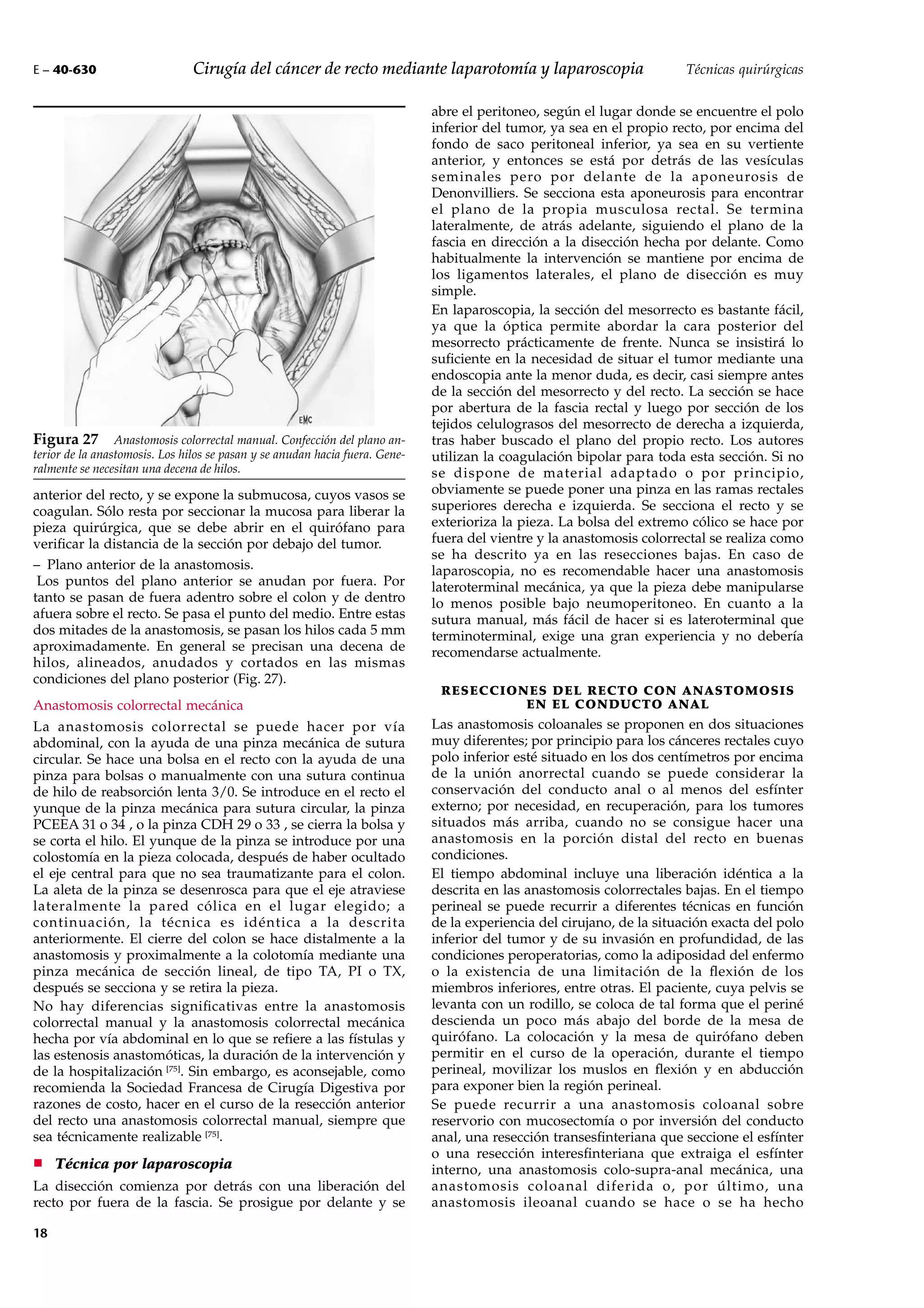 EMC. Cirugía del cáncer de recto mediante laparotomía y laparoscopia | PDF