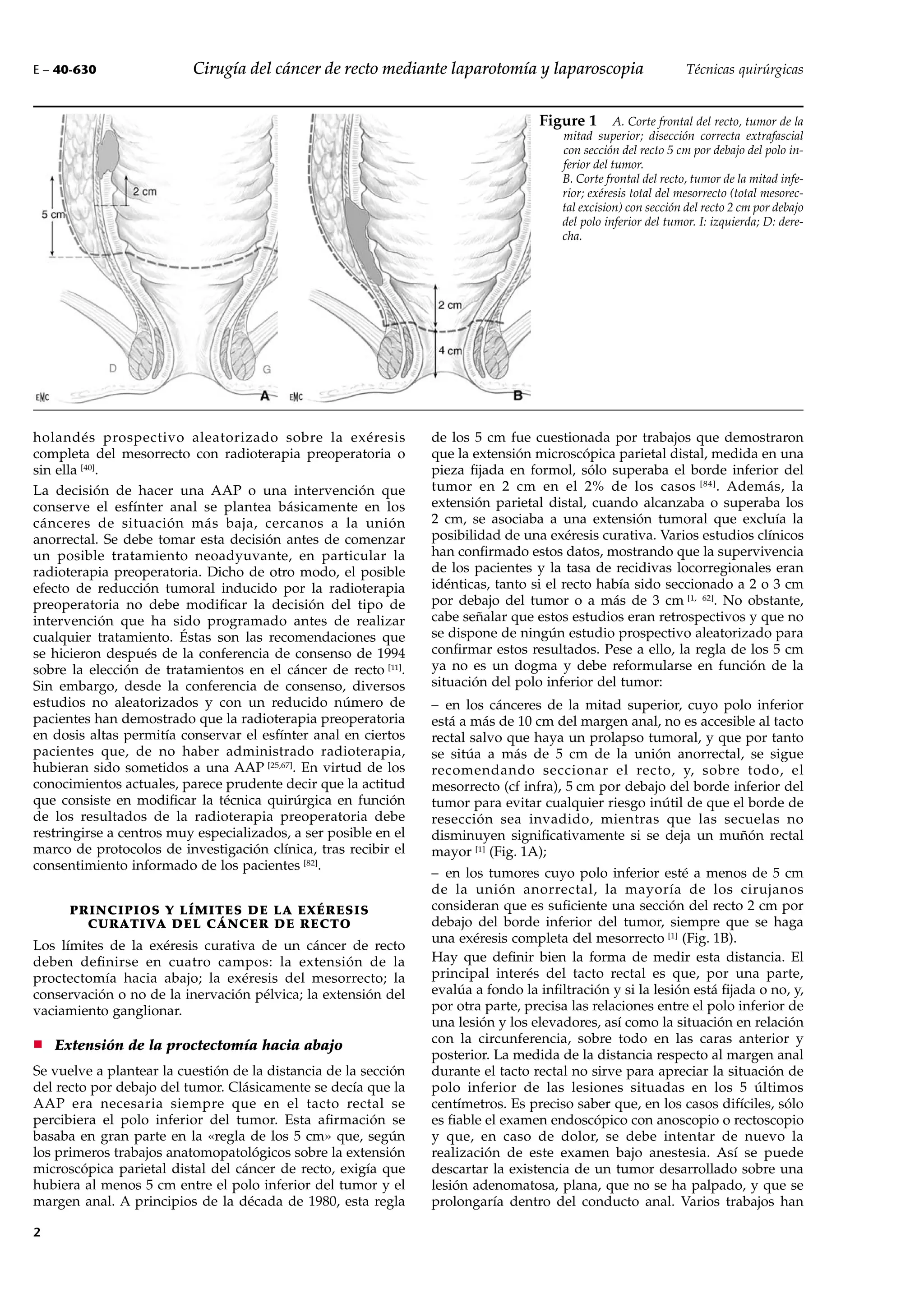 EMC. Cirugía del cáncer de recto mediante laparotomía y laparoscopia | PDF