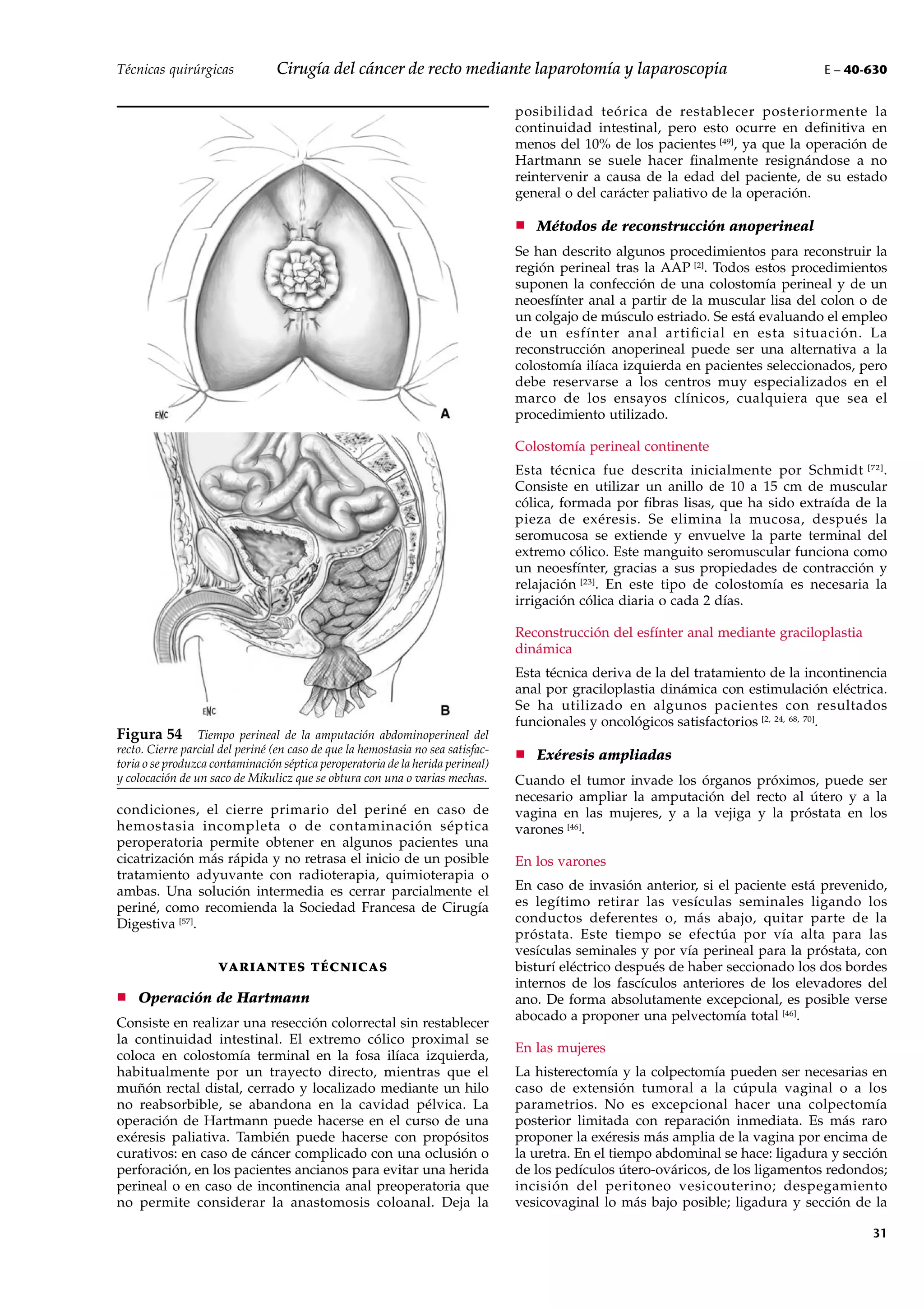 EMC. Cirugía del cáncer de recto mediante laparotomía y laparoscopia | PDF