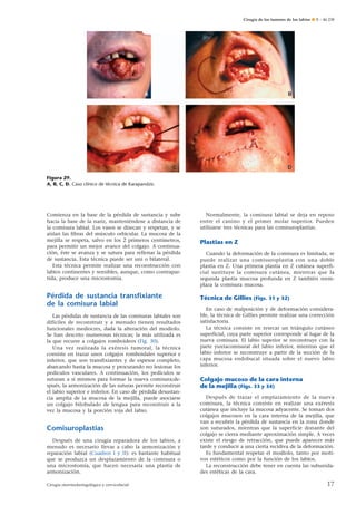Cirugía de los tumores de los labios | PDF