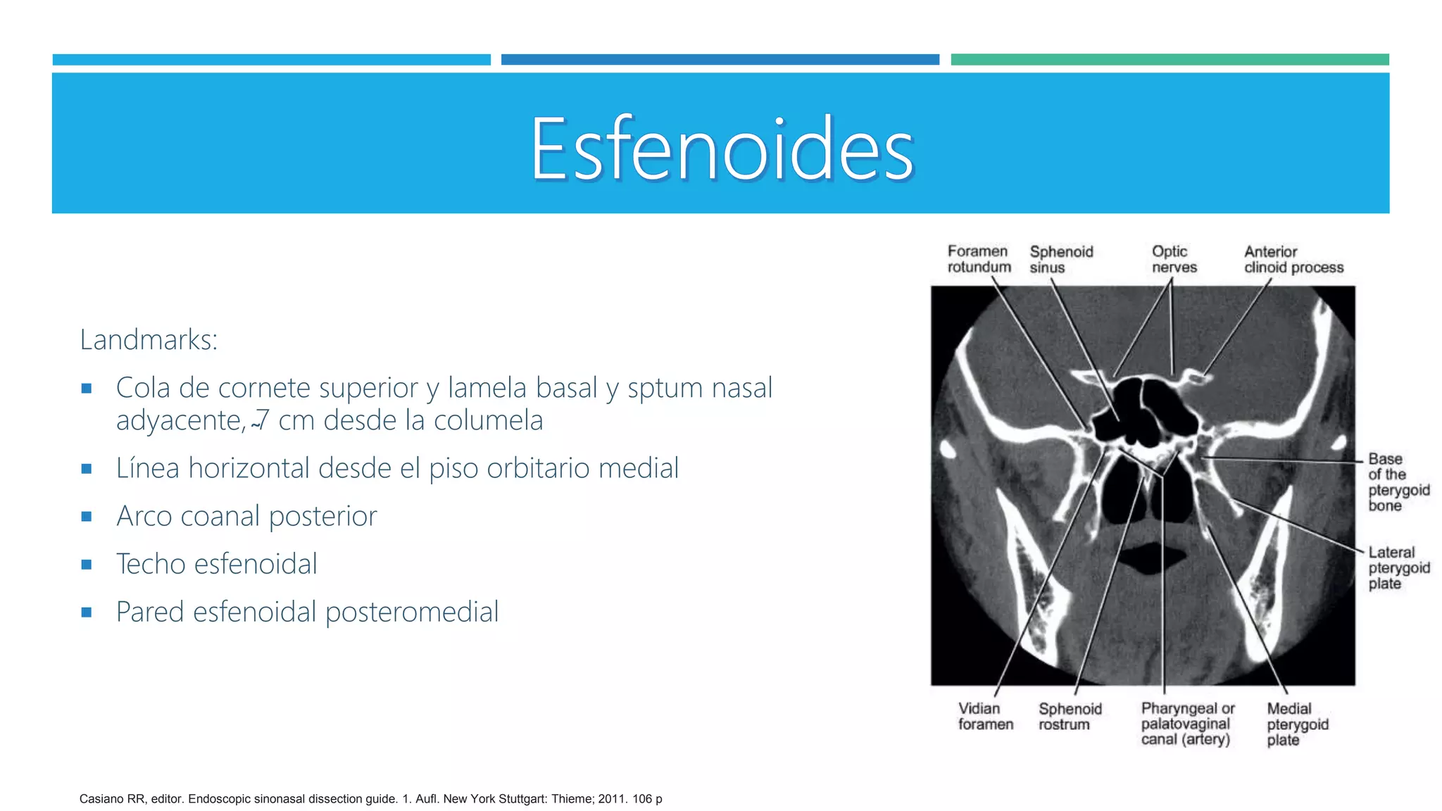 Cirugía de seno frontal, esfenoides y concha dos | PPT