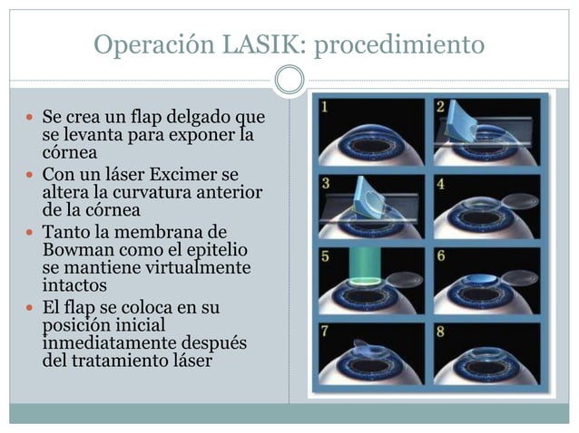 Cirugía refractiva. Operación LASIK | PPT