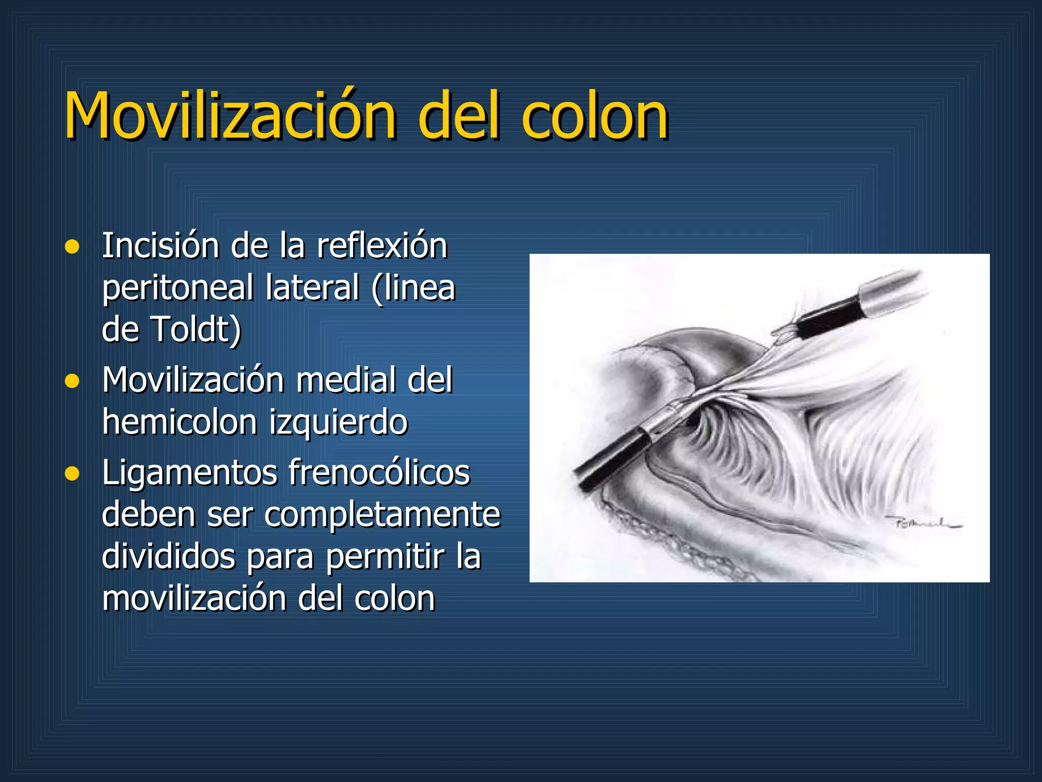 Trasplante renal donador vivo | PPT