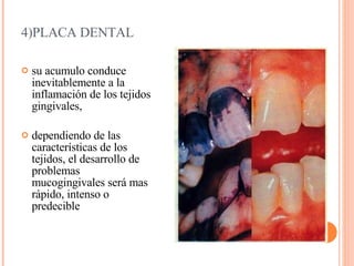 Cirugia Mucogingival En Ortodoncia | PPT