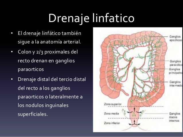 cirugia colon y recto