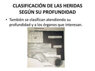 Cirugia2heridas | PPTX