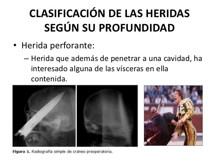 Cirugia2heridas
