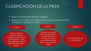 CIRUGIA 3ER MOLAR , exposición de caso clínico | PPTX