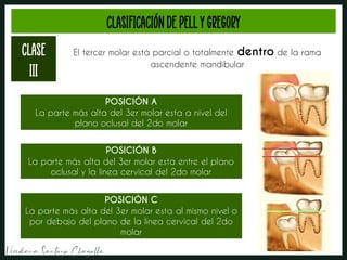 CIRUGIA BUCAL- clasificación de winter pell y gregory.pdf