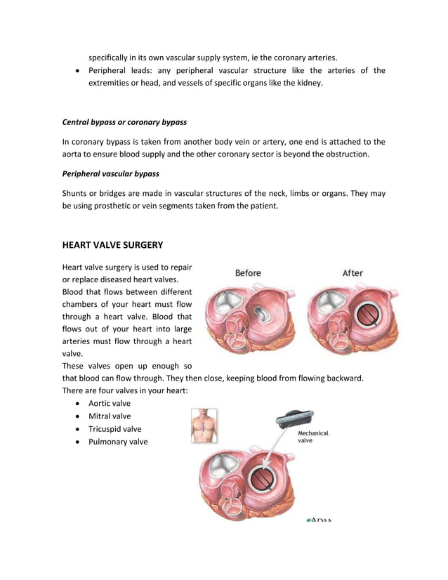 Cirugia cardiovascular ingles | DOCX | Heart and Cardiovascular ...