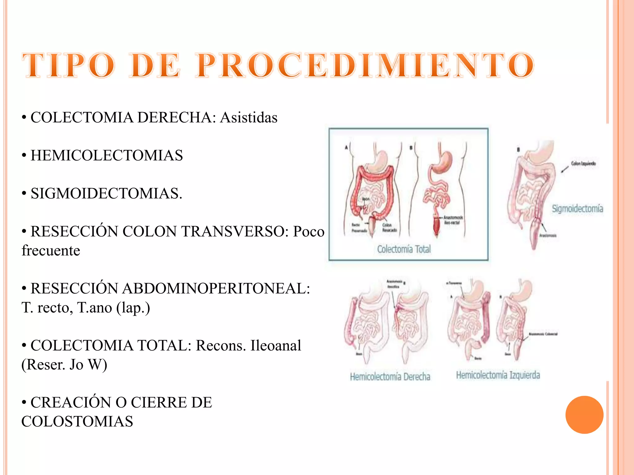 Cirugia de colon para instrumentadores via laparoscopica | PPT