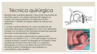 CIRUGIA DEL tabique nasales (septumplastia).pptx