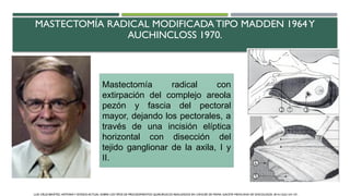 Cancer de mama, historia y evolucion de la cirugia | PPTX