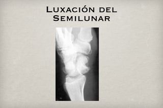 Cirugia de mano | PPT