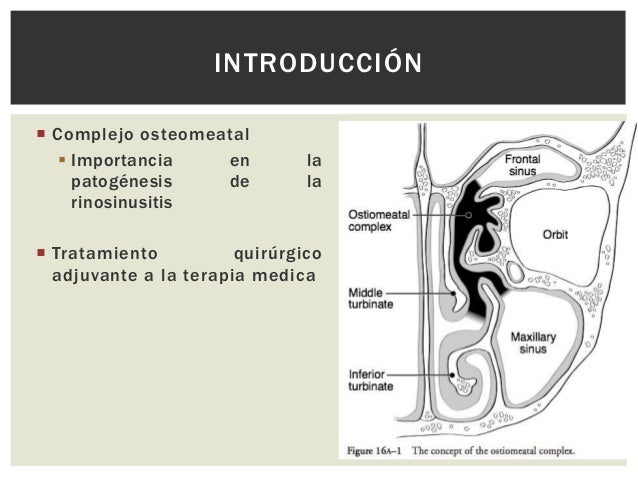 Cirugia de seno maxilar y etmoidal