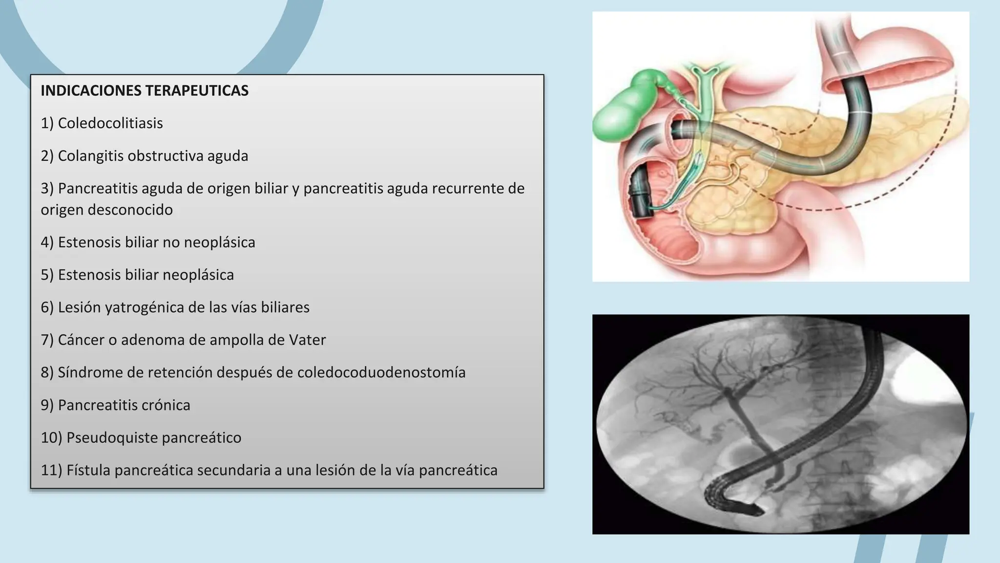 Anatomía de la vía biliar. pptx | PPTX