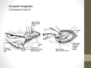 Cirugia plástica Ocular | PPTX