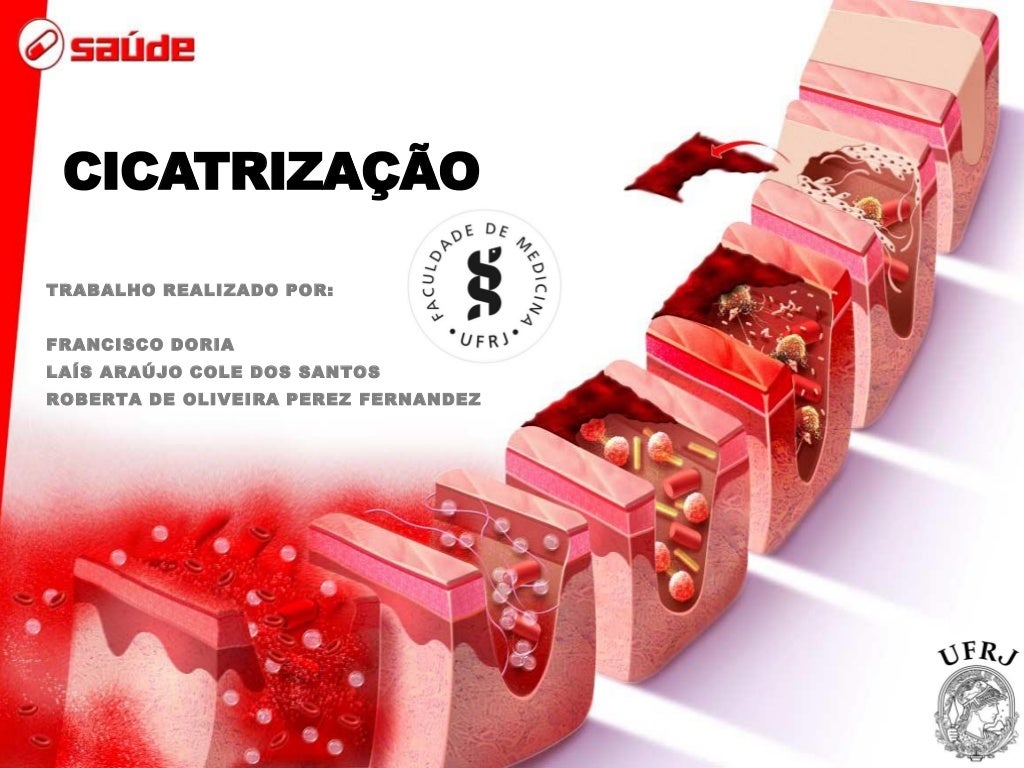 Cicatrização de Feridas em Cirurgia