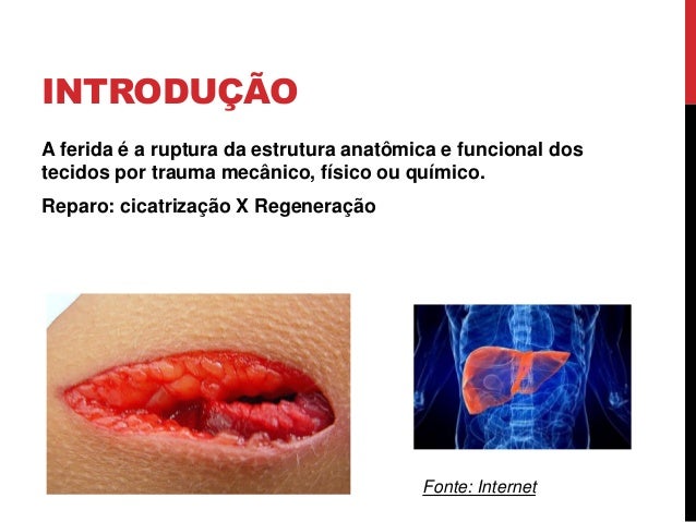 Cicatrização de Feridas em Cirurgia