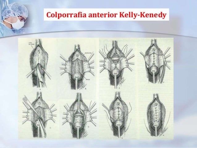 Cirurgia ginecológica passado, presente e futuro 2019