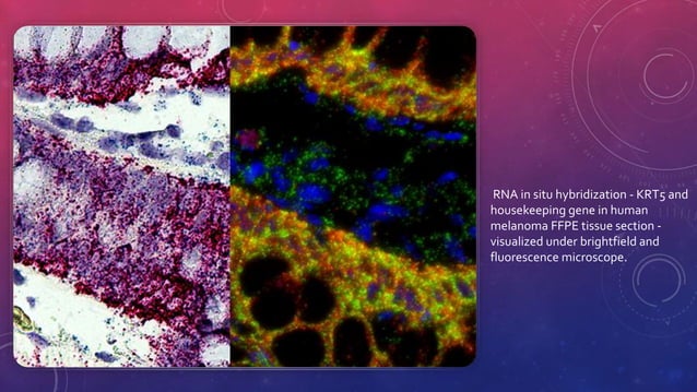 Cish | PPTX | Endocrine and Metabolic Diseases | Diseases and Conditions