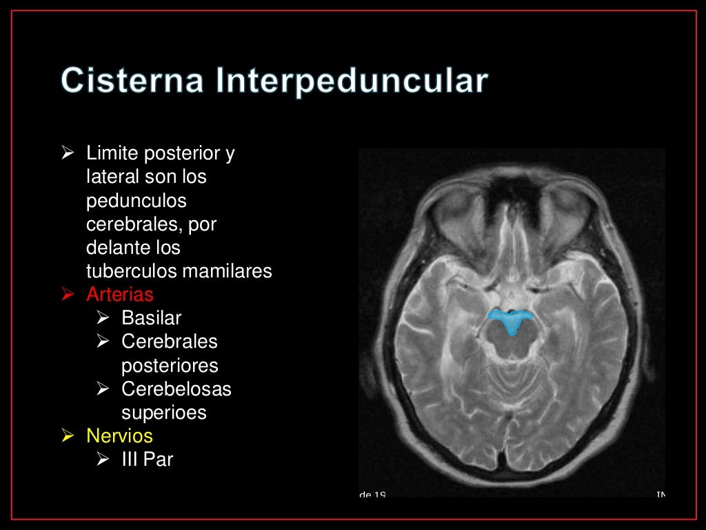 Cisterna Ambiens Structural Characterization Of SLYM A 4th Meningeal