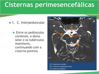 Cisternas subaracnoideas, anatomia .pptx