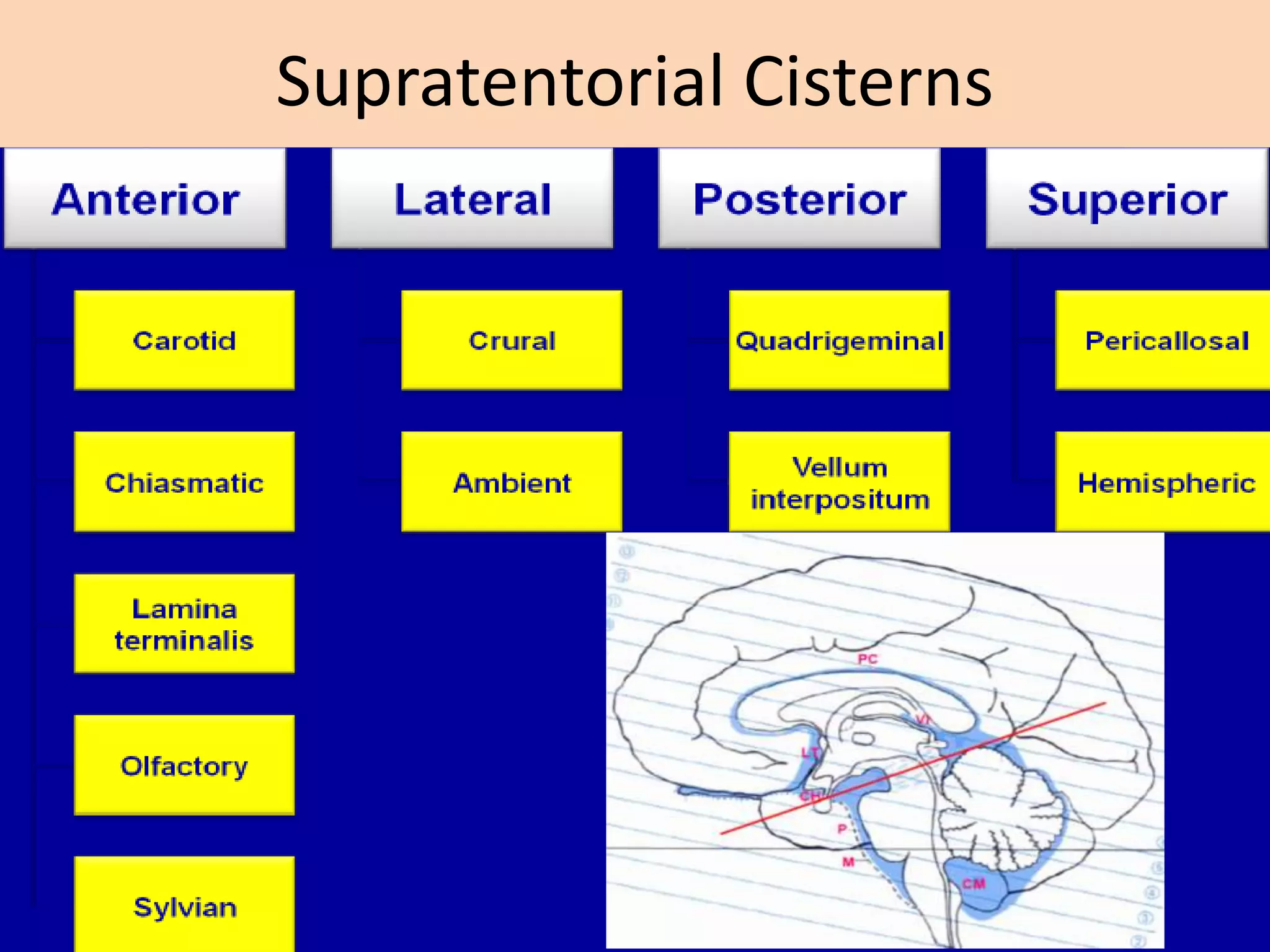 Cisterns of brain and its contents along with its classification and ...