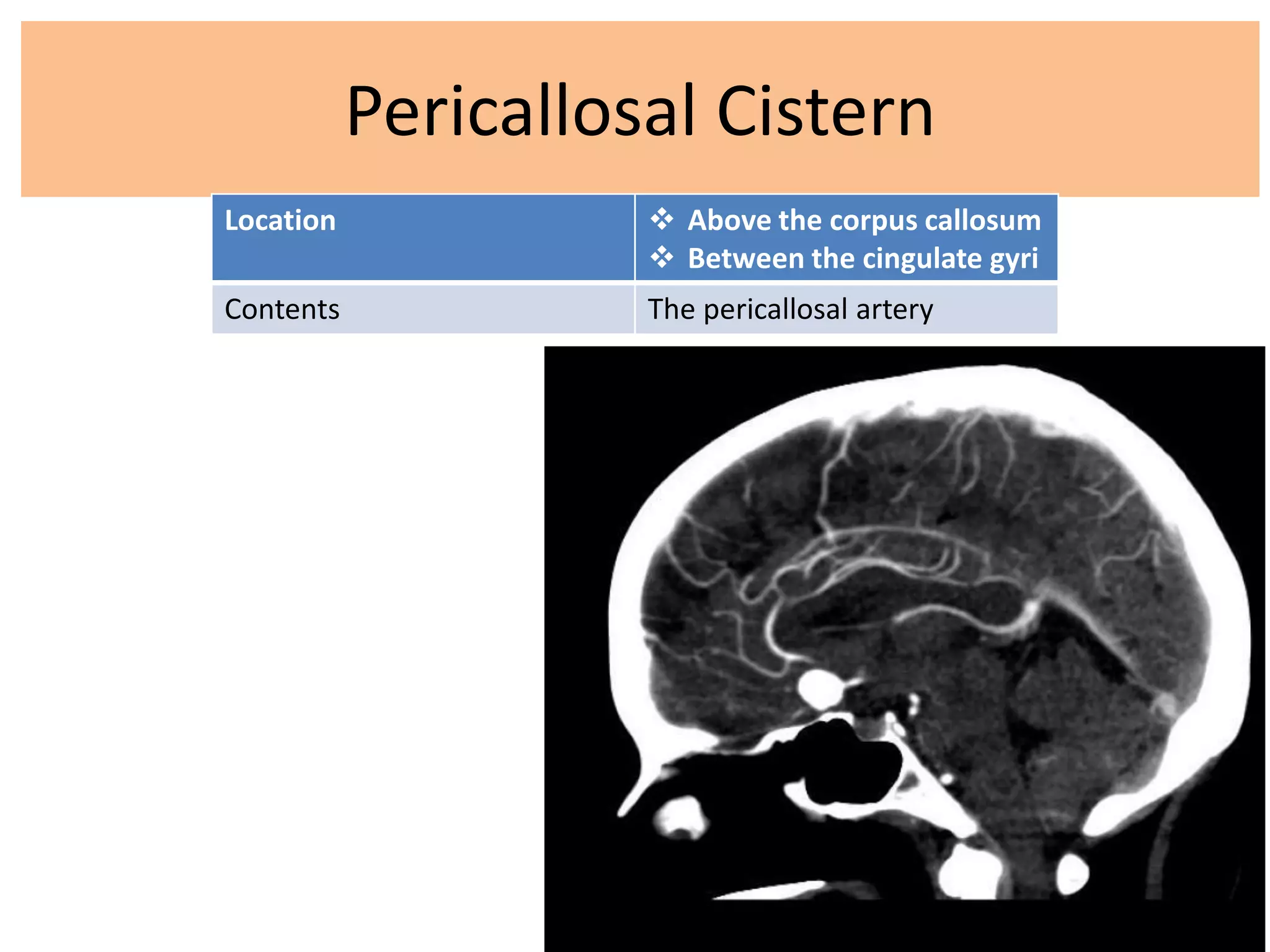 Cisterns of brain and its contents along with its classification and ...