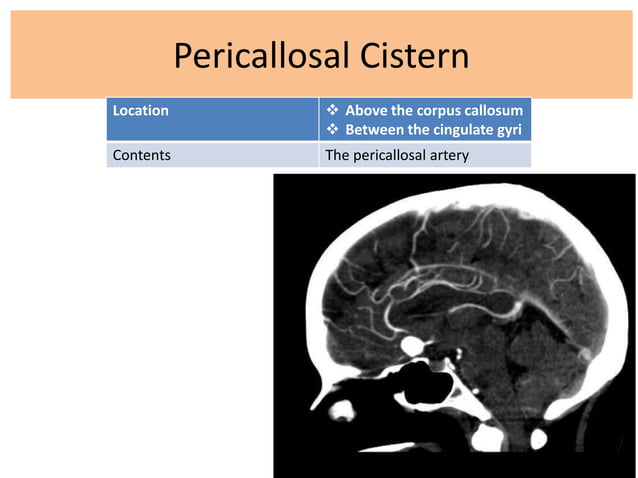 Cisterns of brain and its contents along with its classification and ...
