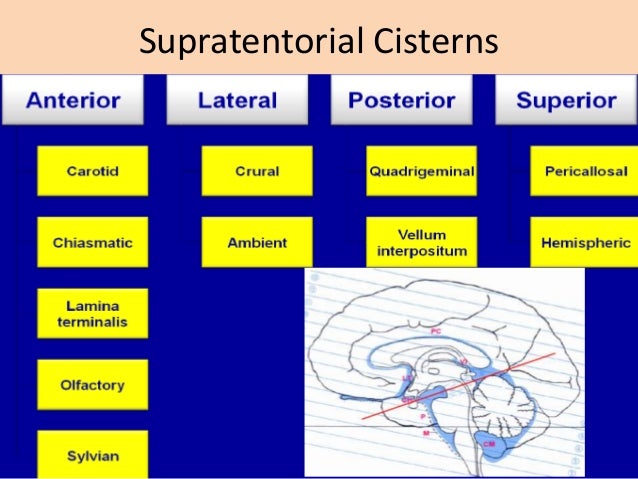 Cisterns of brain and its contents along with its classification and
