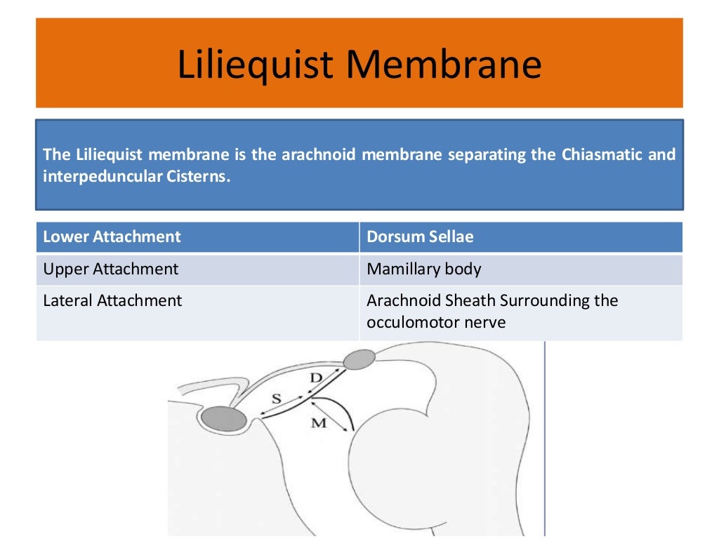 Cisternae Pronunciation