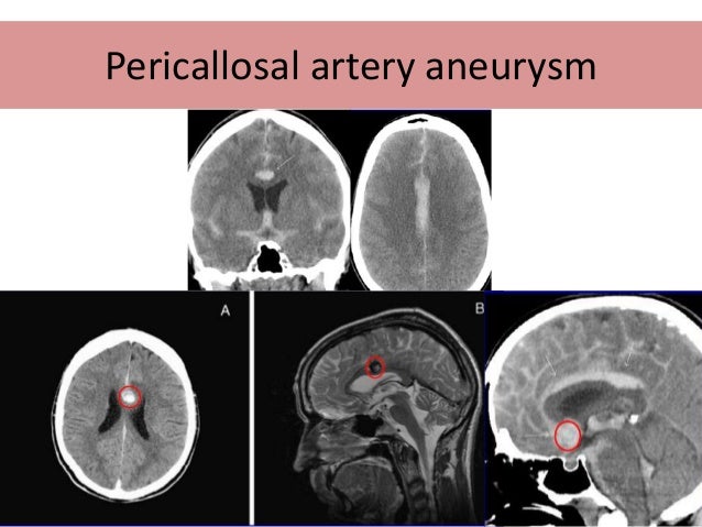 What Are Cisternae Brainlyin