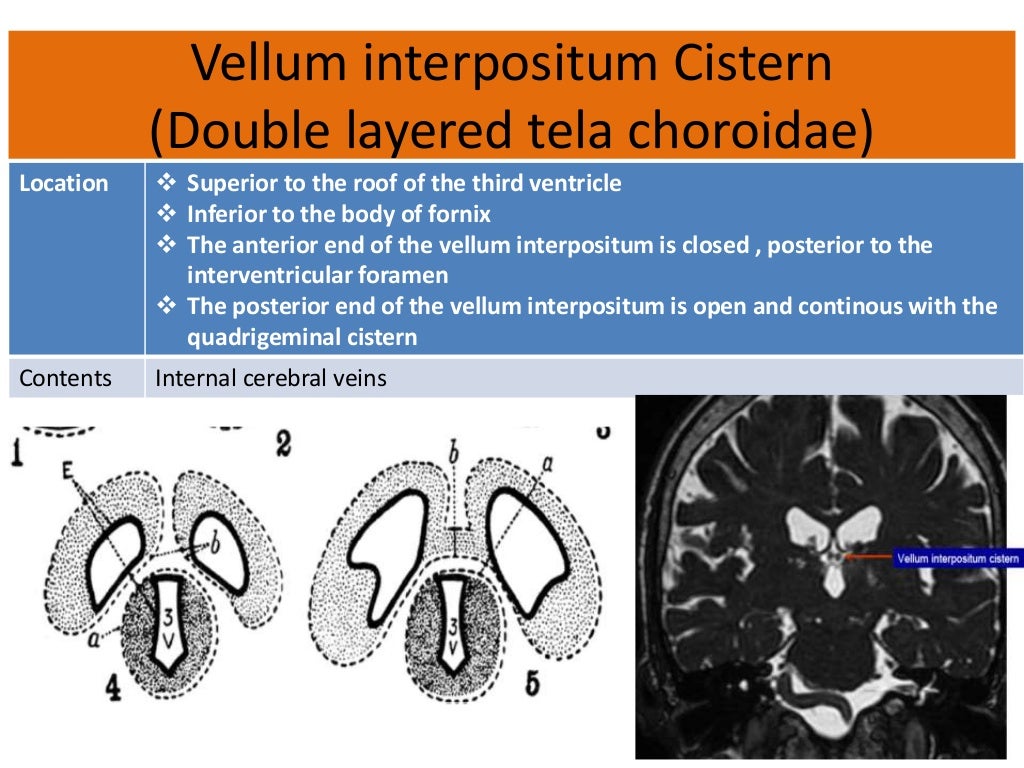 What Is Difference Between Cristae And Cisternae Quora
